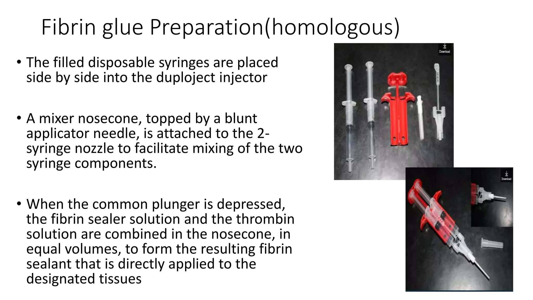FIBRIN GLUE IN OPHTHALMOLOGY.pptx