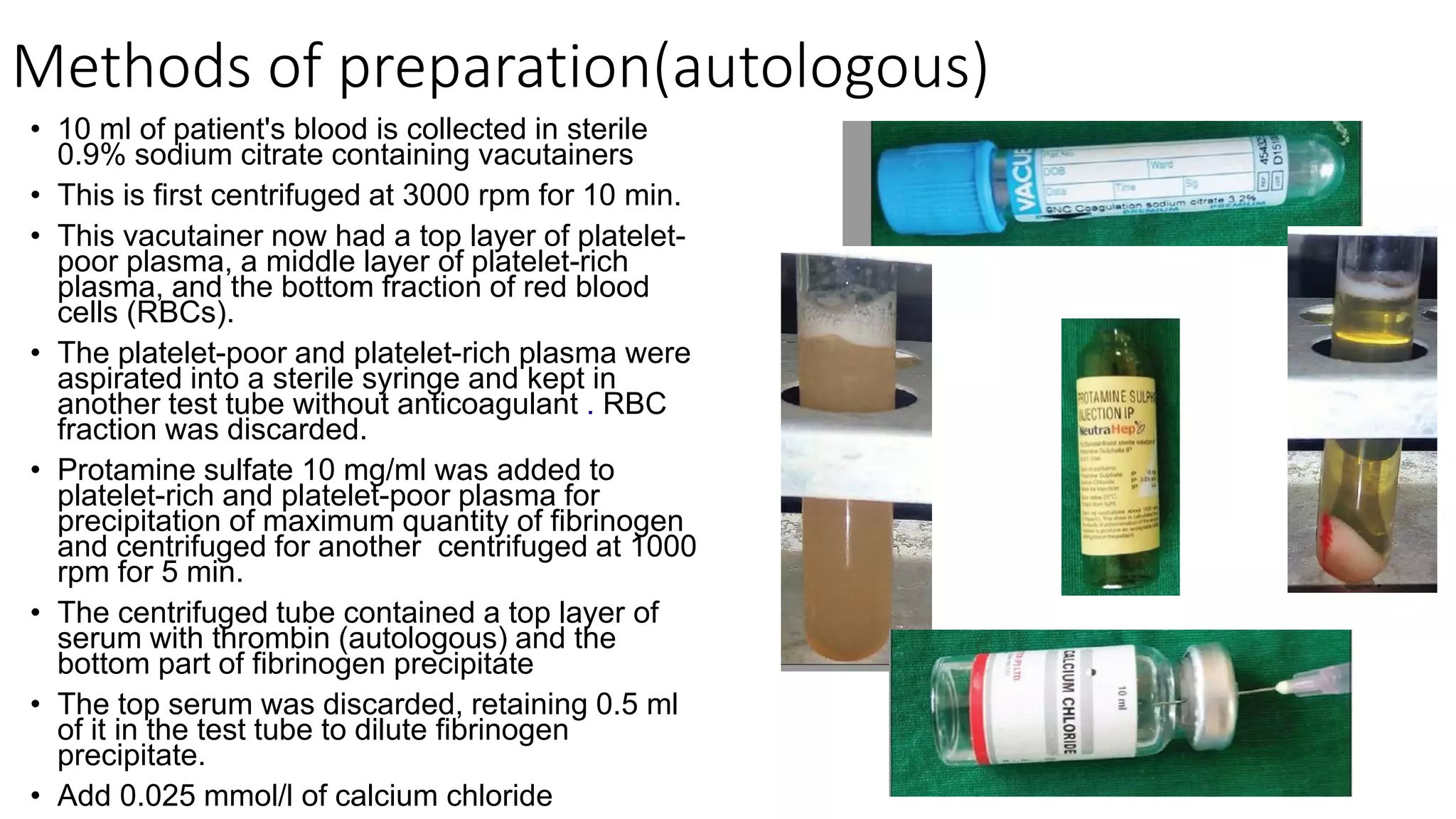 FIBRIN GLUE IN OPHTHALMOLOGY.pptx