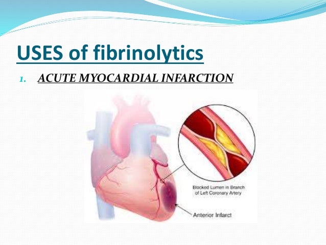 Fibrinolytics and antifibrinolytics