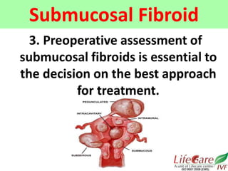 Great Tips of Managing FIBROIDS with INFERTILITY, Dr. Sharda Jain | PPT