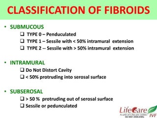 Great Tips of Managing FIBROIDS with INFERTILITY, Dr. Sharda Jain | PPT