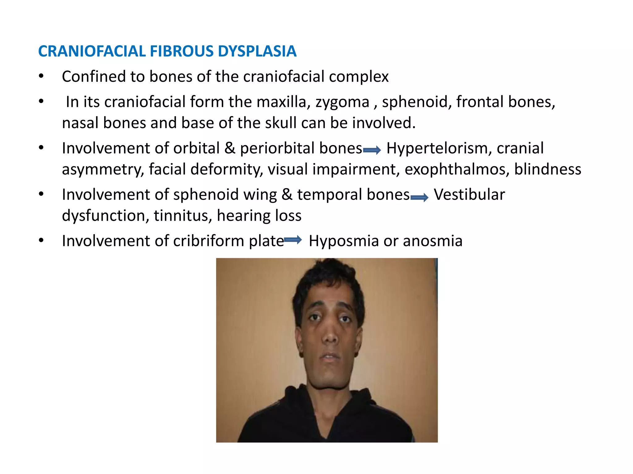Fibro osseous lesions | PPTX