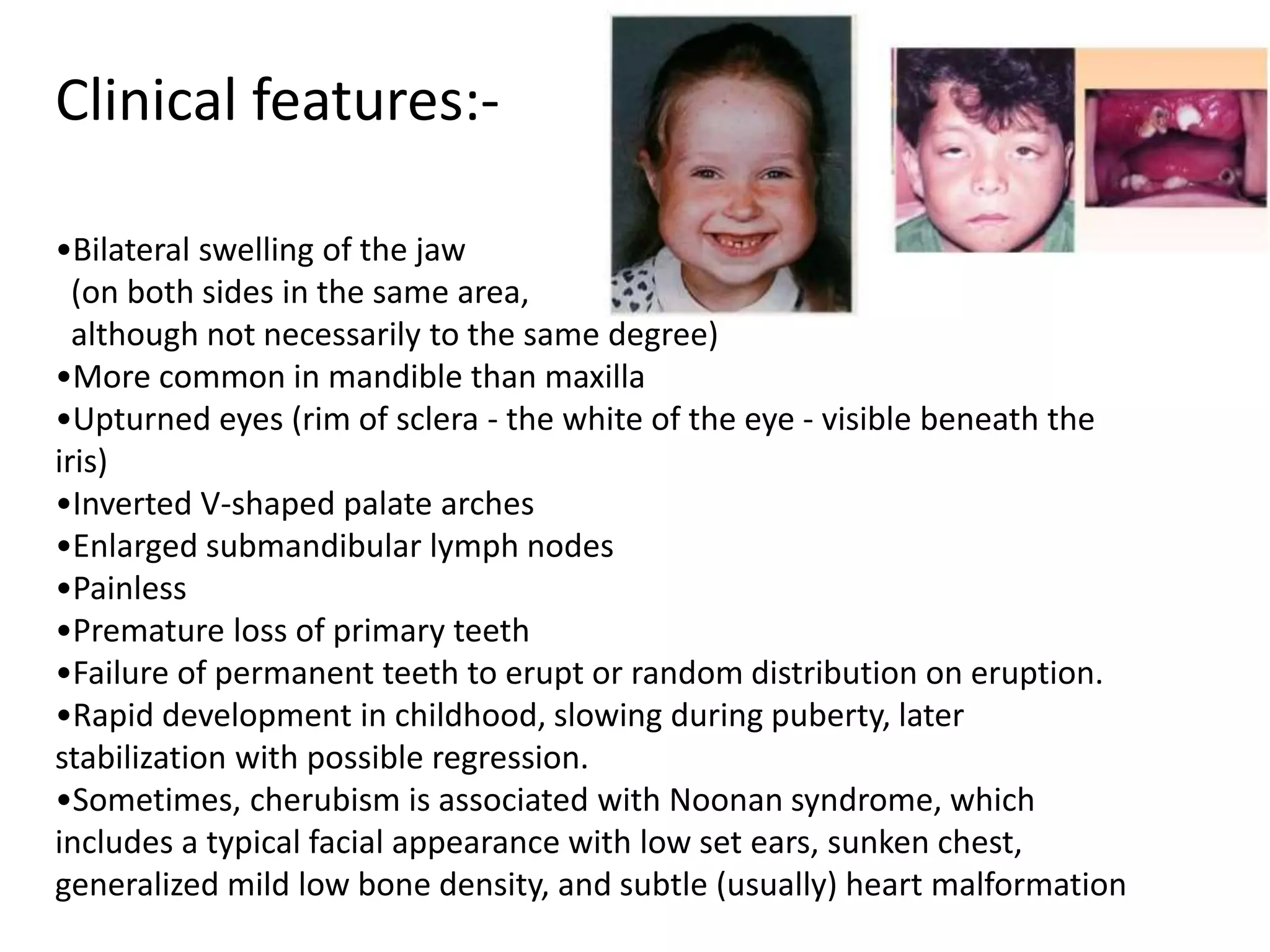 Fibro osseous lesions | PPTX