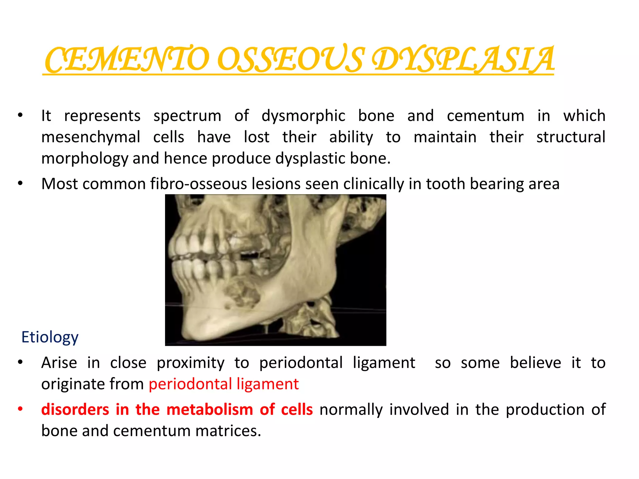 Fibro osseous lesions | PPTX