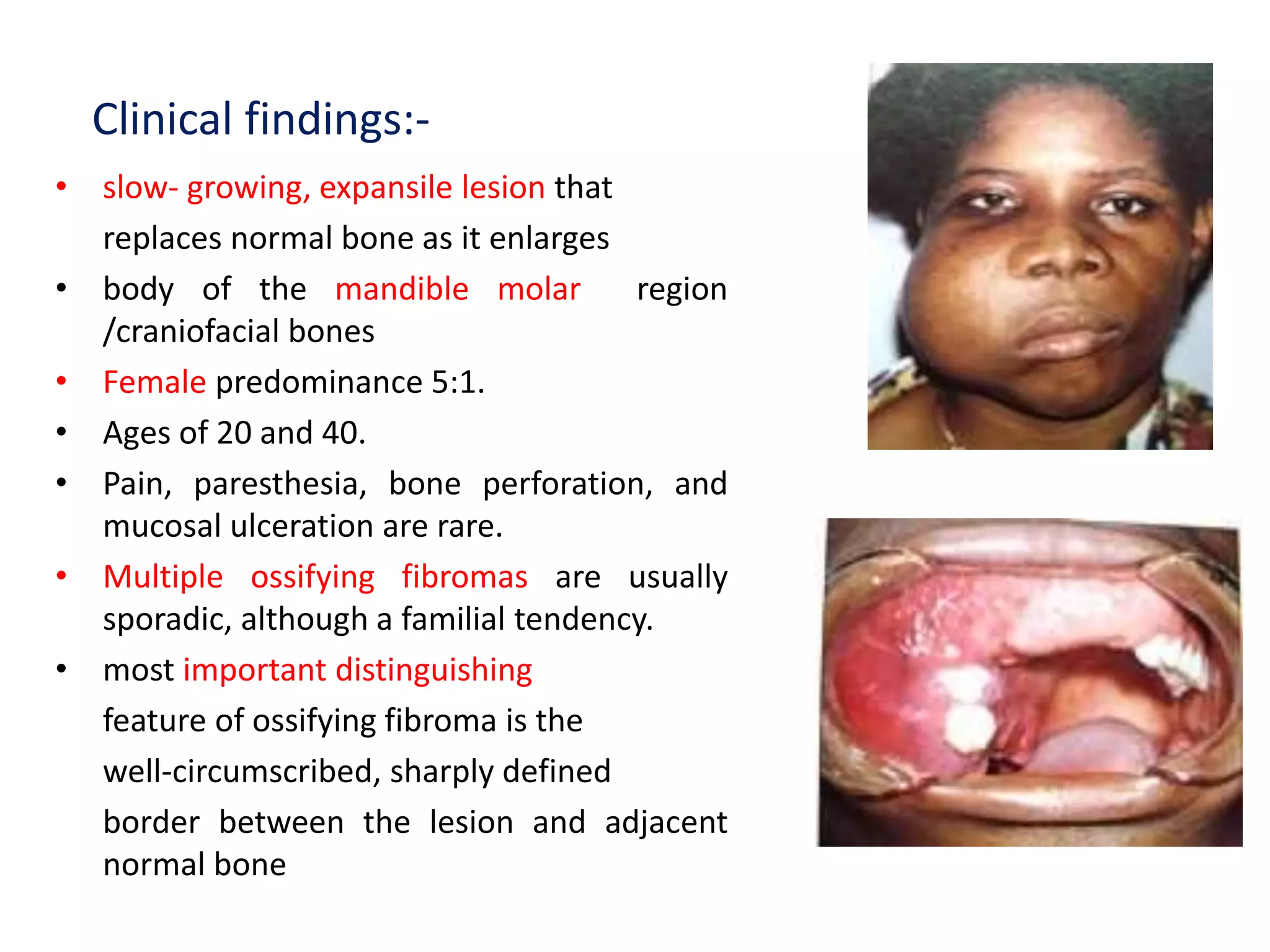 Fibro osseous lesions | PPT