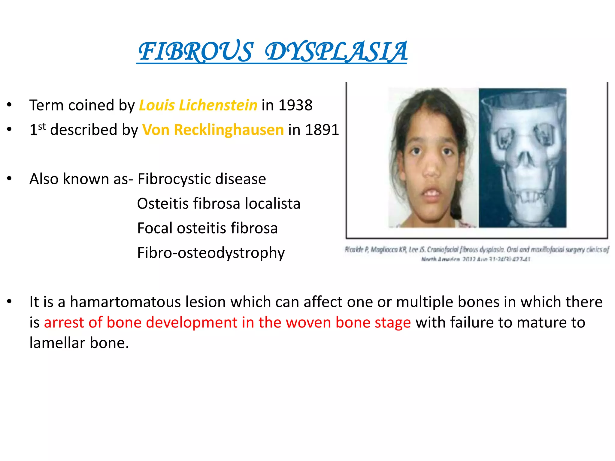 Fibro osseous lesions | PPTX