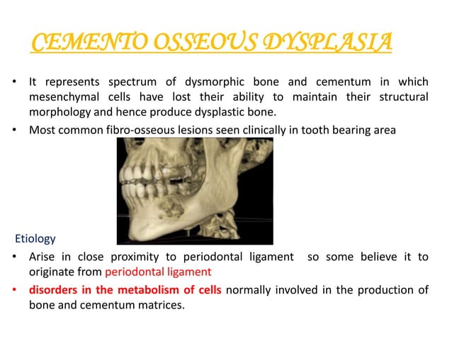 Fibro osseous lesions | PPT