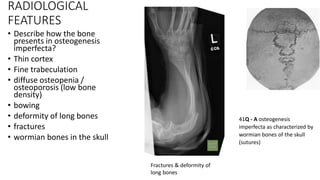 Fibro-osseous Lesions oral pathology notes | PDF