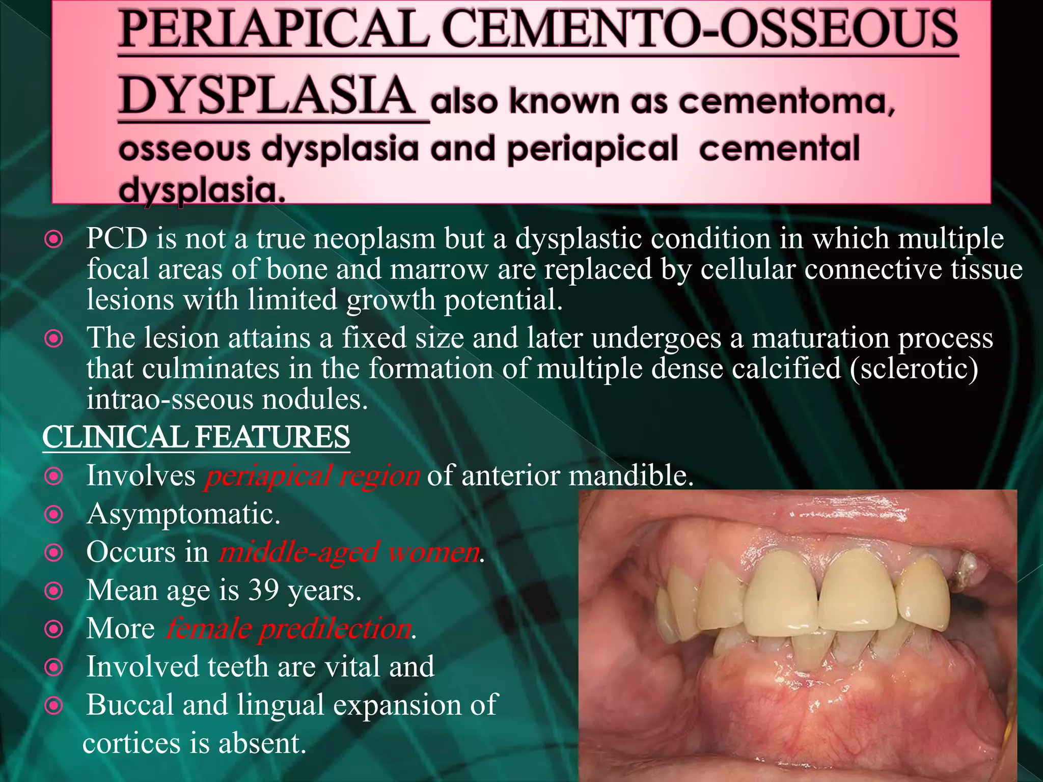Fibro osseous lesions of jaw | PPTX