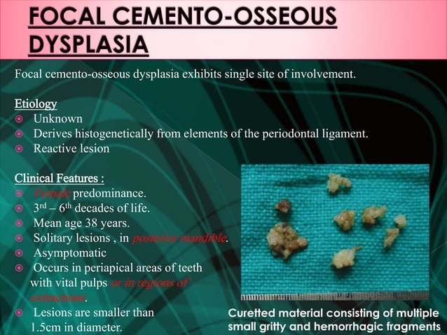 Fibro osseous lesions of jaw | PPTX