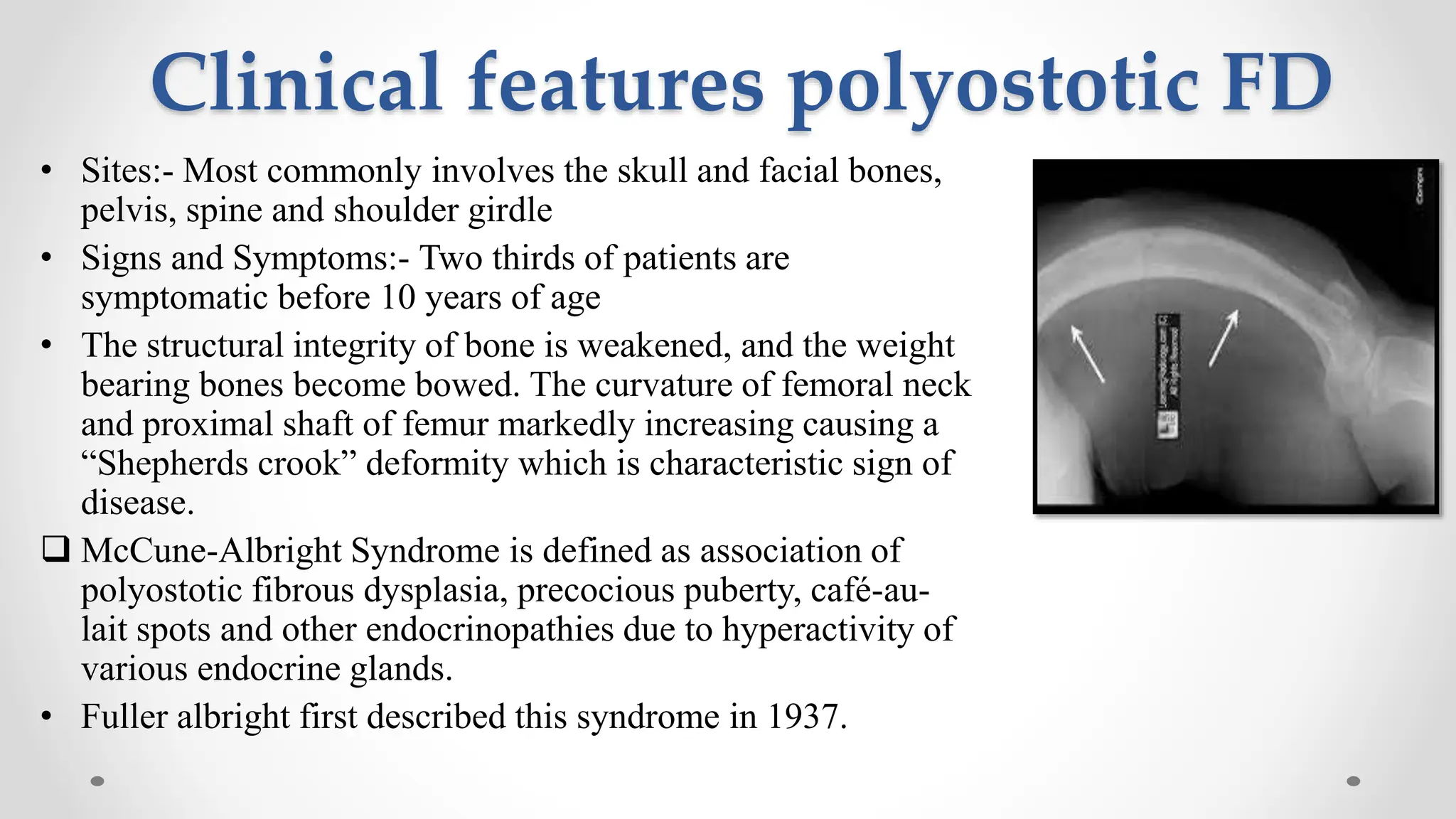 FIBRO-OSSEOUS LESIONS OF JAW(1).pptx UP.pptx