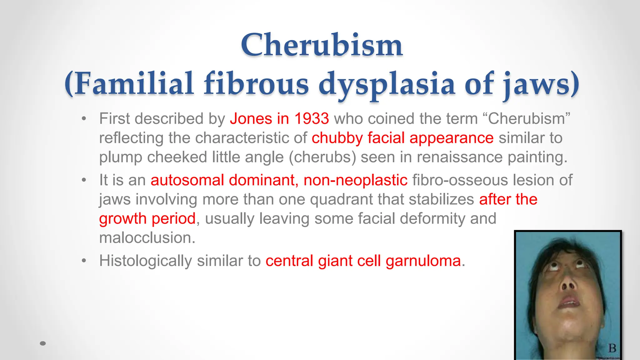FIBRO-OSSEOUS LESIONS OF JAW(1).pptx UP.pptx