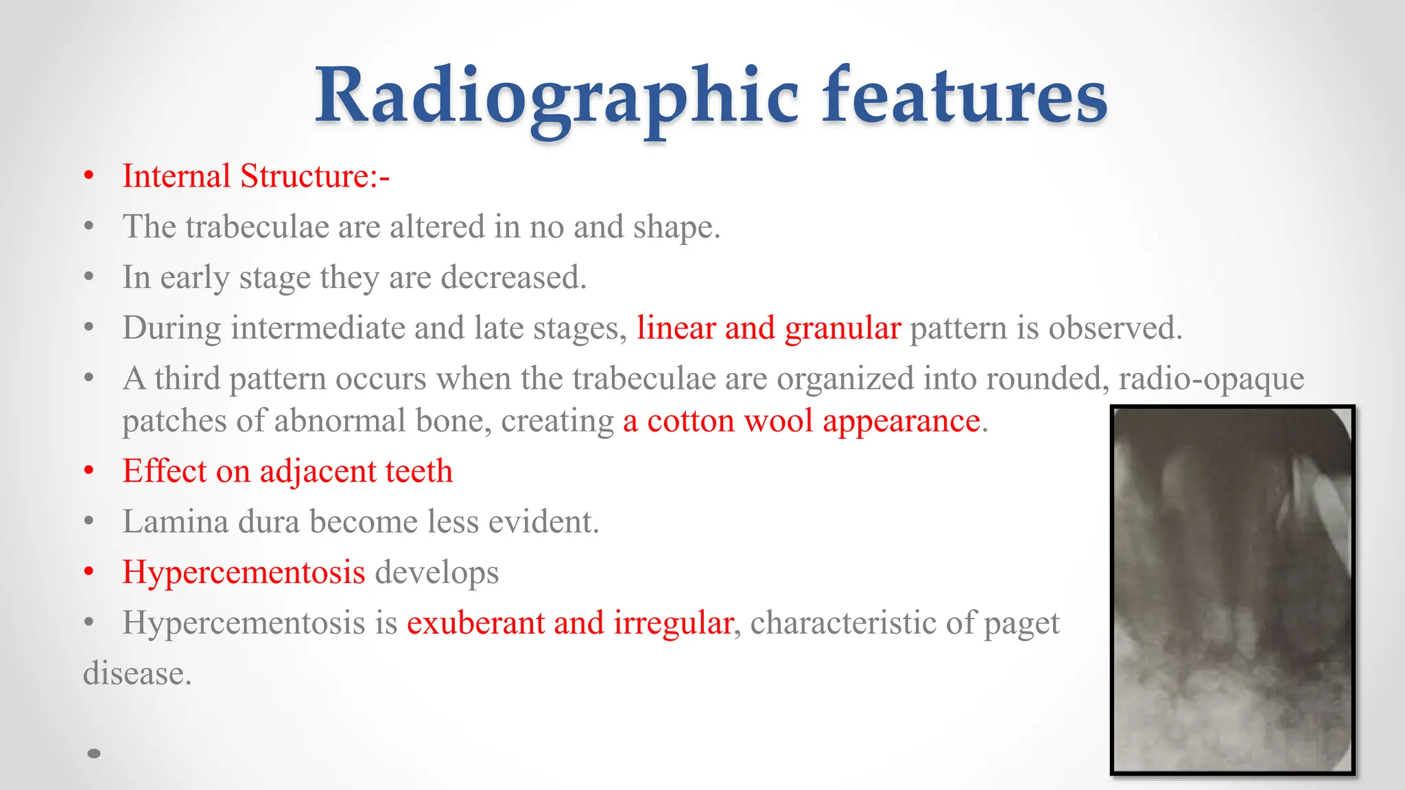 FIBRO-OSSEOUS LESIONS OF JAW(1).pptx UP.pptx