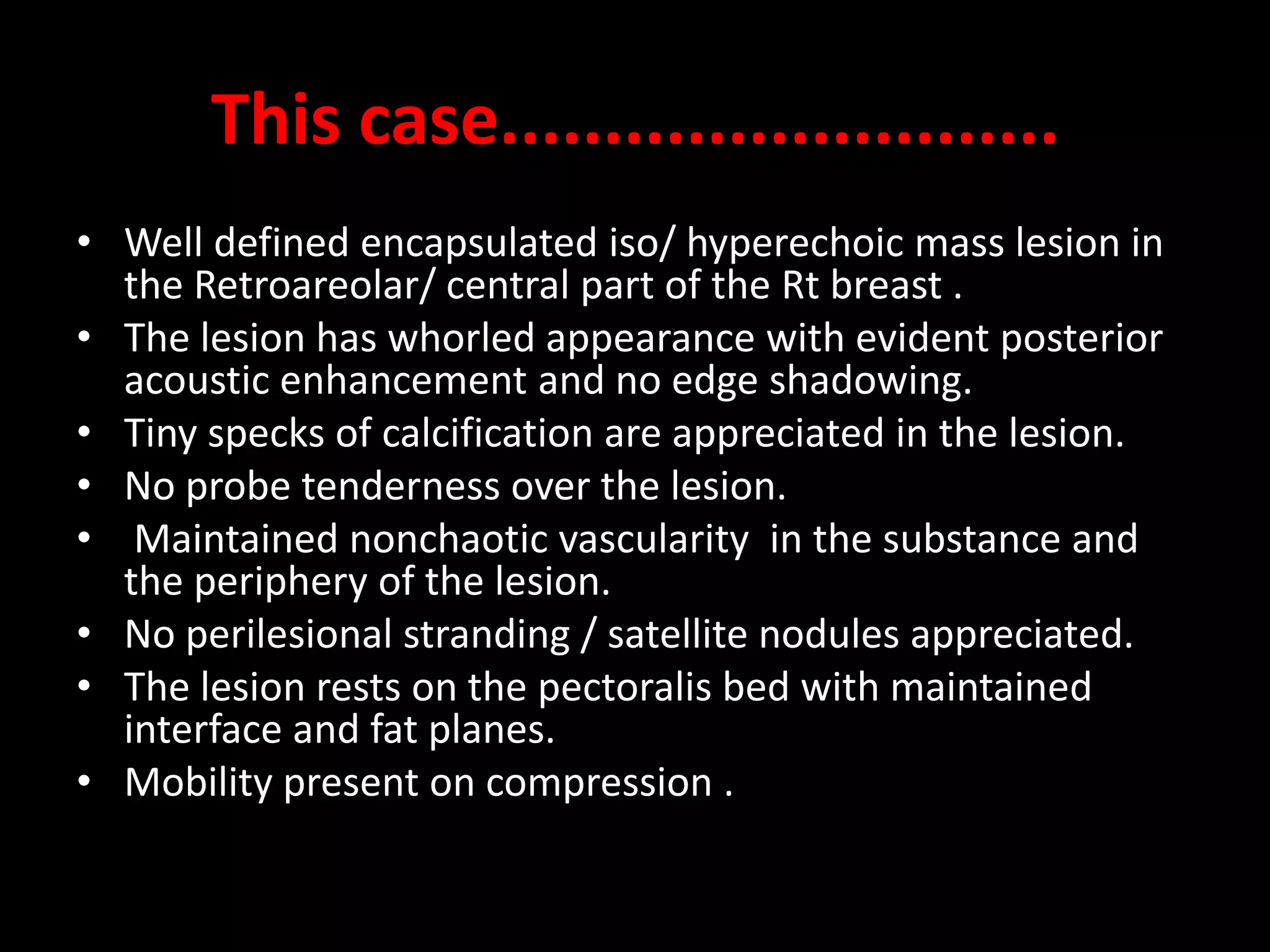 Fibroadenoma breast | PPTX