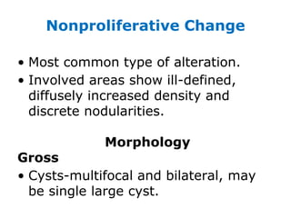 Fibroadenoma, Fibrocytic and Mastitis | PPTX