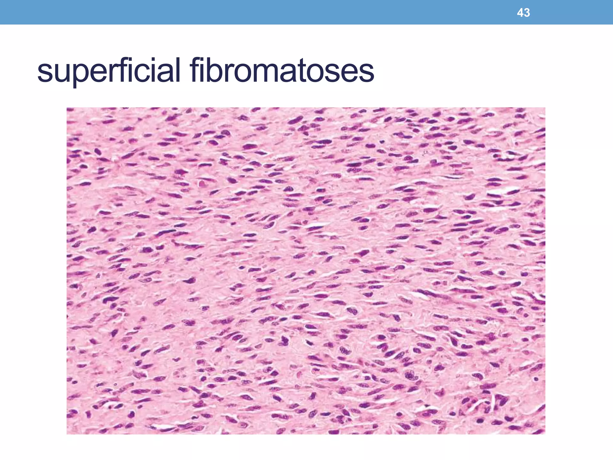 Fibroblasts in Health and Disease | PPTX