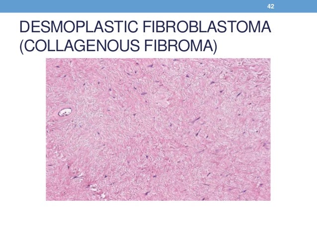 Fibroblasts in Health and Disease