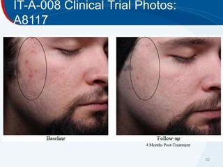 Fibrocell Power Point | PPTX