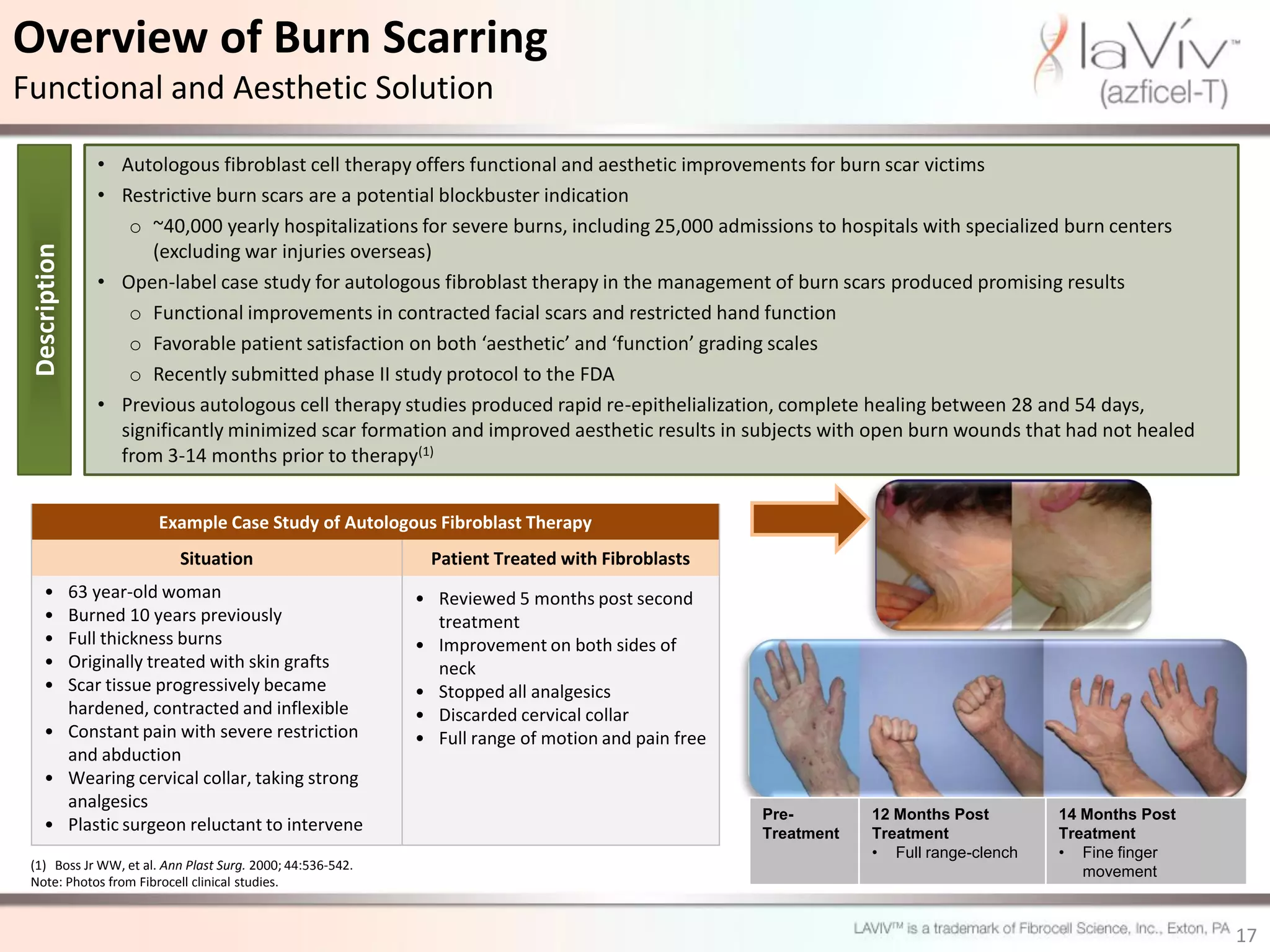 Fibrocell science investor-presentation-august_2012 | PDF