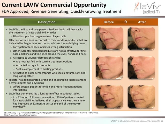 Fibrocell science investor-presentation-august_2012 | PDF | Skin and ...