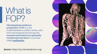 Fibrodysplasia Ossificans Progressiva.pdf