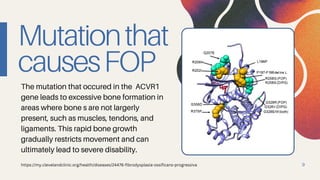 Fibrodysplasia Ossificans Progressiva.pdf