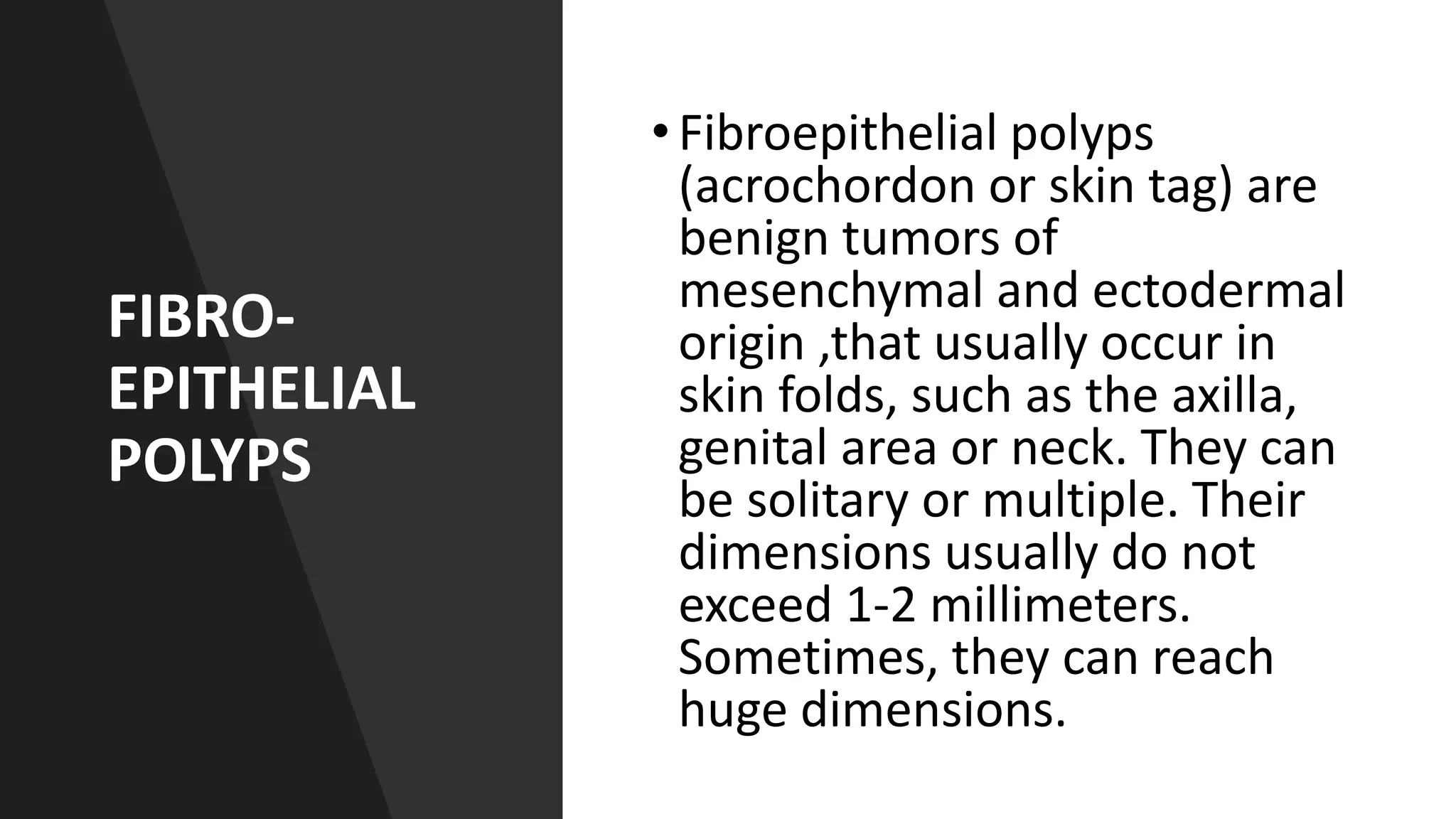 Fibroepithelial polyps.pptx