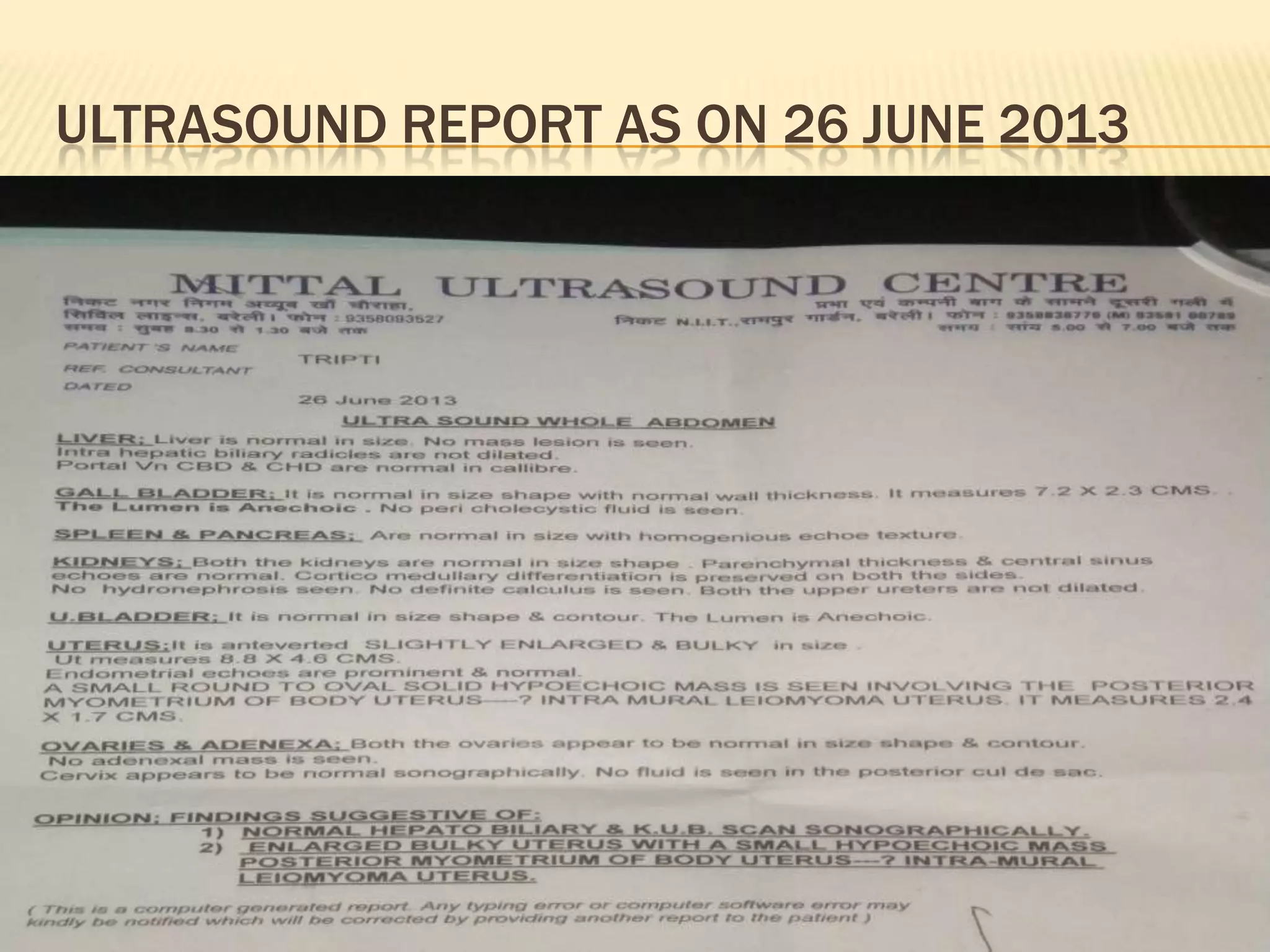 Fibroid cure by homeopathy | PPT