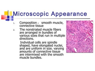 Fibroid2 | PPT