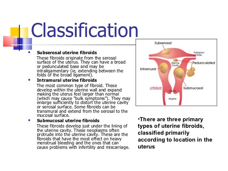 Fibroid2