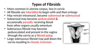 Fibroid abnormal uterine bleed OBG phase | PPTX