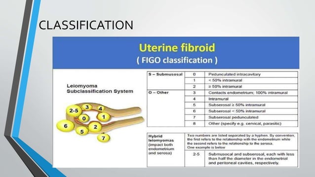 FIBROID%20UTERUS%20FINAL%20PPT copy.pptx
