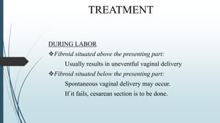 Fibroid complicating pregnancy | PPTX