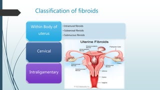 Fibroid complicating pregnancy | PPTX