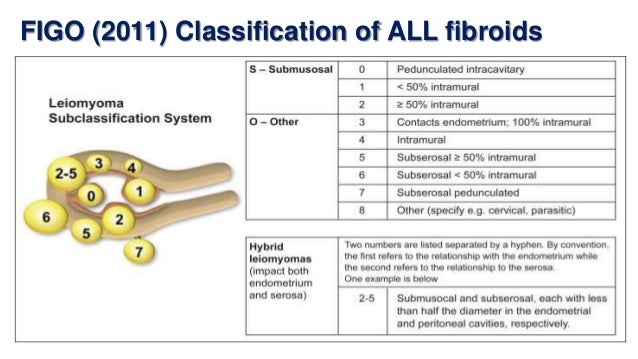 Myoma and Infertility: What next?