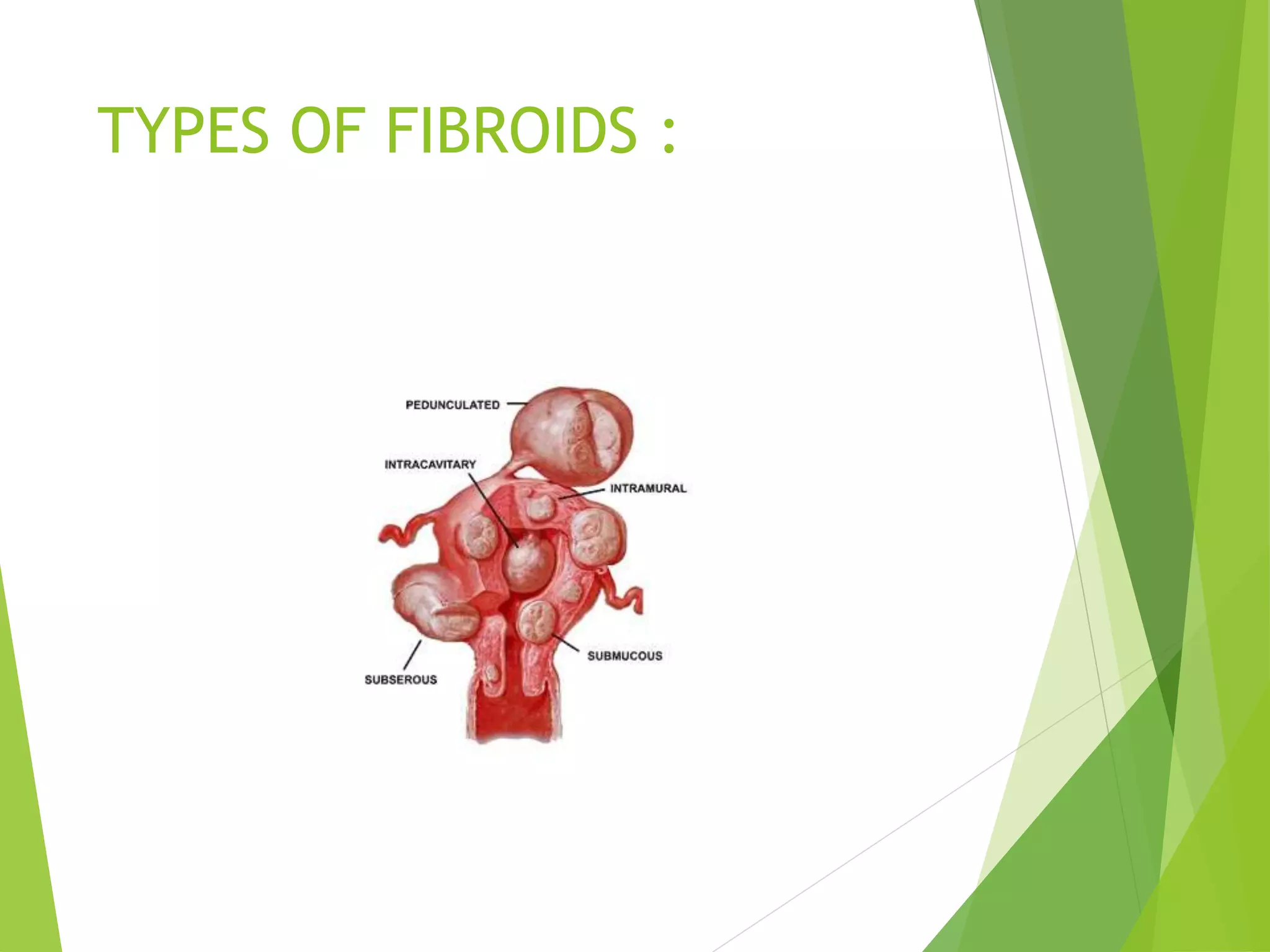 fibroid presentation.ppt