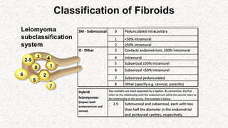 Fibroid_presentation1233333333333333.pptx | Pregnancy | Reproductive Health