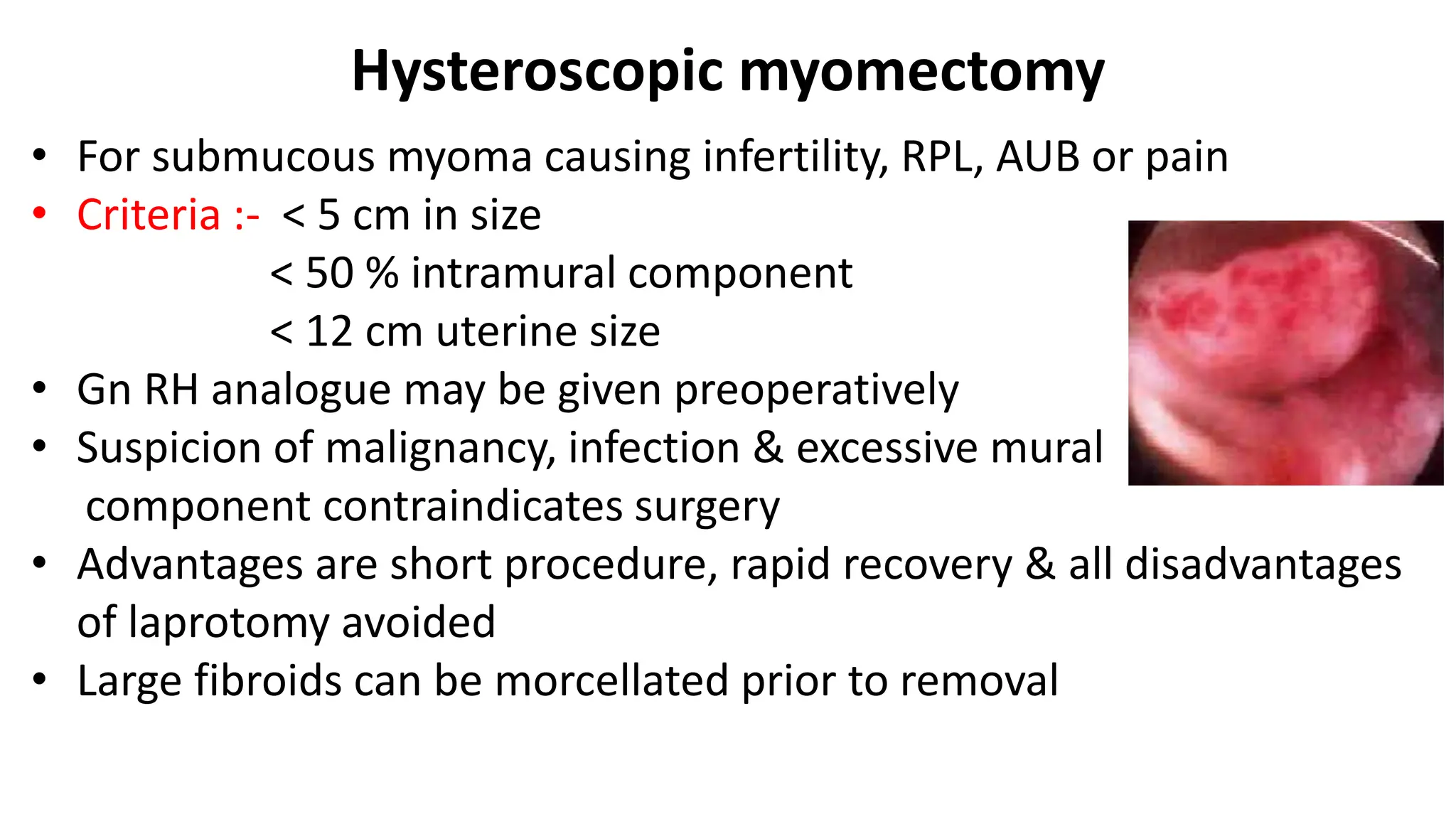 uterine Fibroid by dr Richa choudhary.pptx
