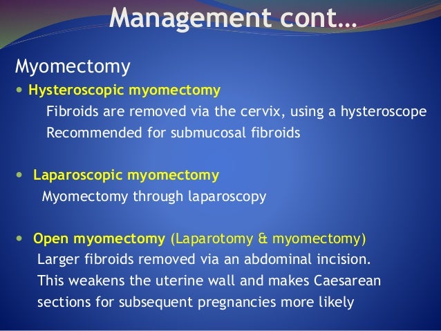 Fibroids