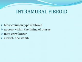 Fibroids- defination, symptoms , types, causes and treatment in females ...