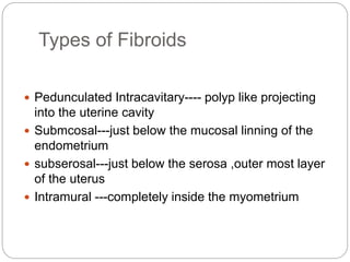 Fibroids | PPT