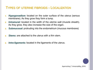 Uterine Fibroids | PPTX