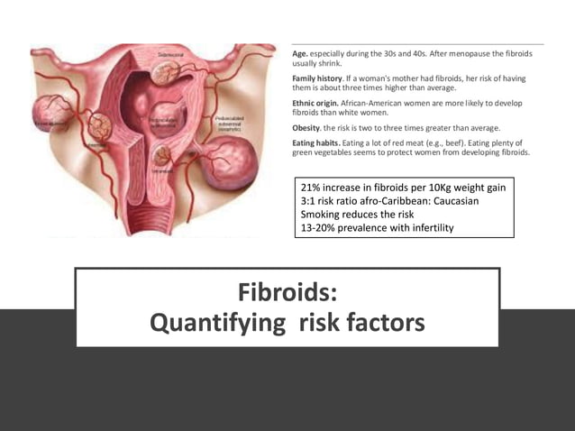 Uterine Fibroids (Leiomyomata): Investigations and Treatment | PDF