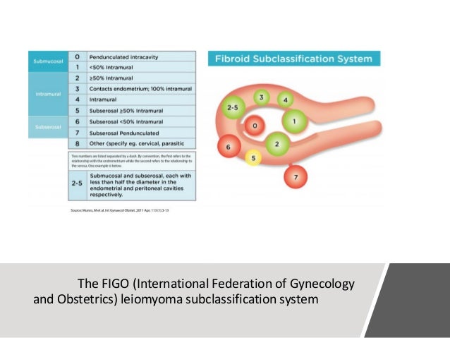Uterine Fibroids Leiomyomata Investigations And Treatment