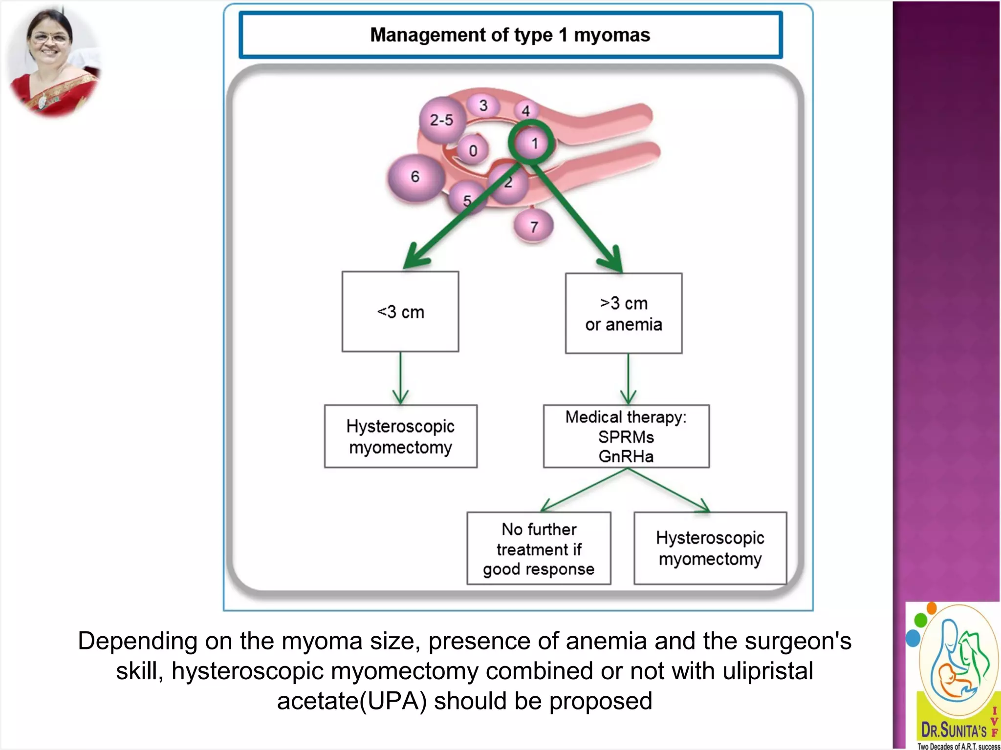 FIBROIDS AND INFERTILITY | PPT