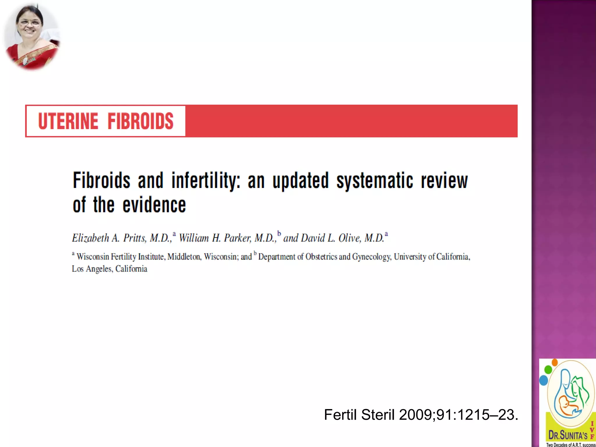 FIBROIDS AND INFERTILITY | PPT