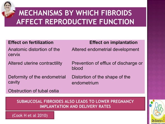 FIBROIDS AND INFERTILITY | PPT