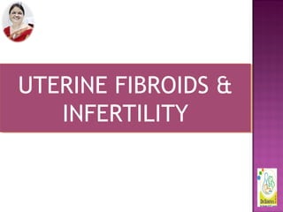 FIBROIDS AND INFERTILITY | PPT