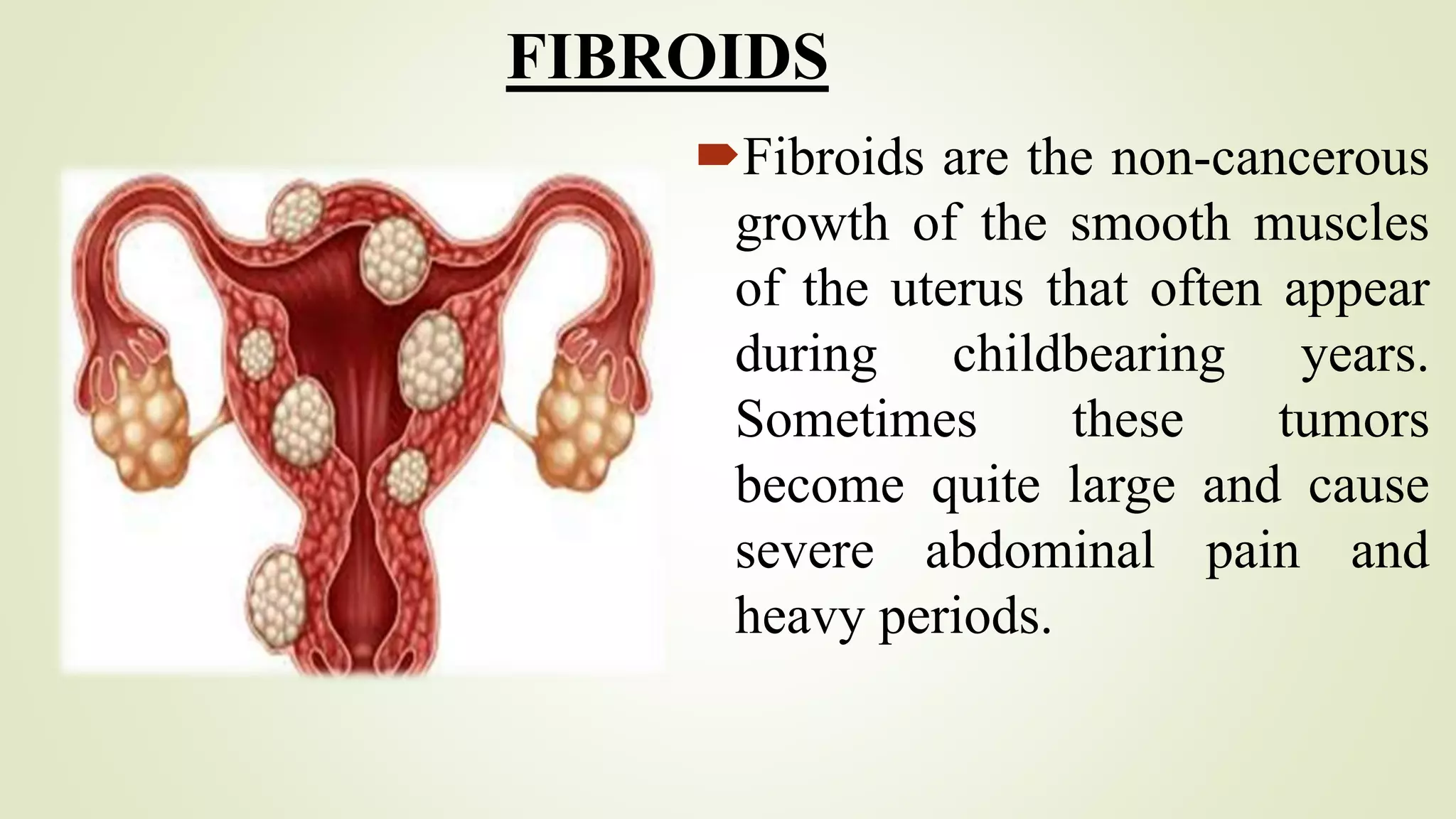 FIBROIDS PPT.pptx