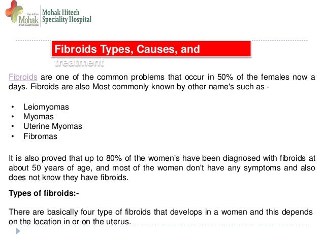 Fibroids: Types, Causes, and treatment
